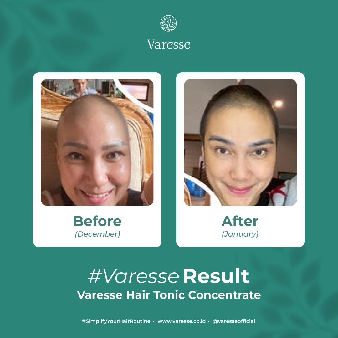 Varesse Hair Loss Defense